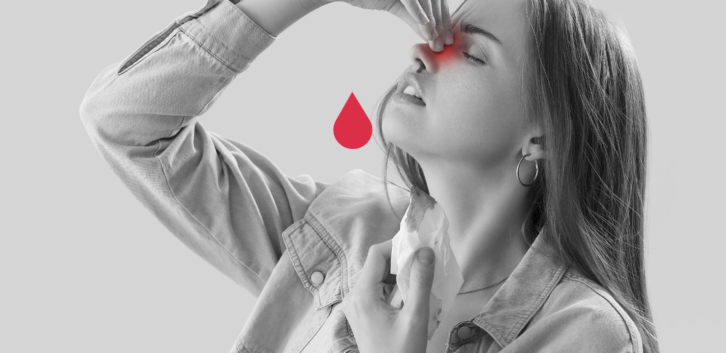 Major causes of Nosebleed | Nursing Home in Delhi | UK Nursing Home